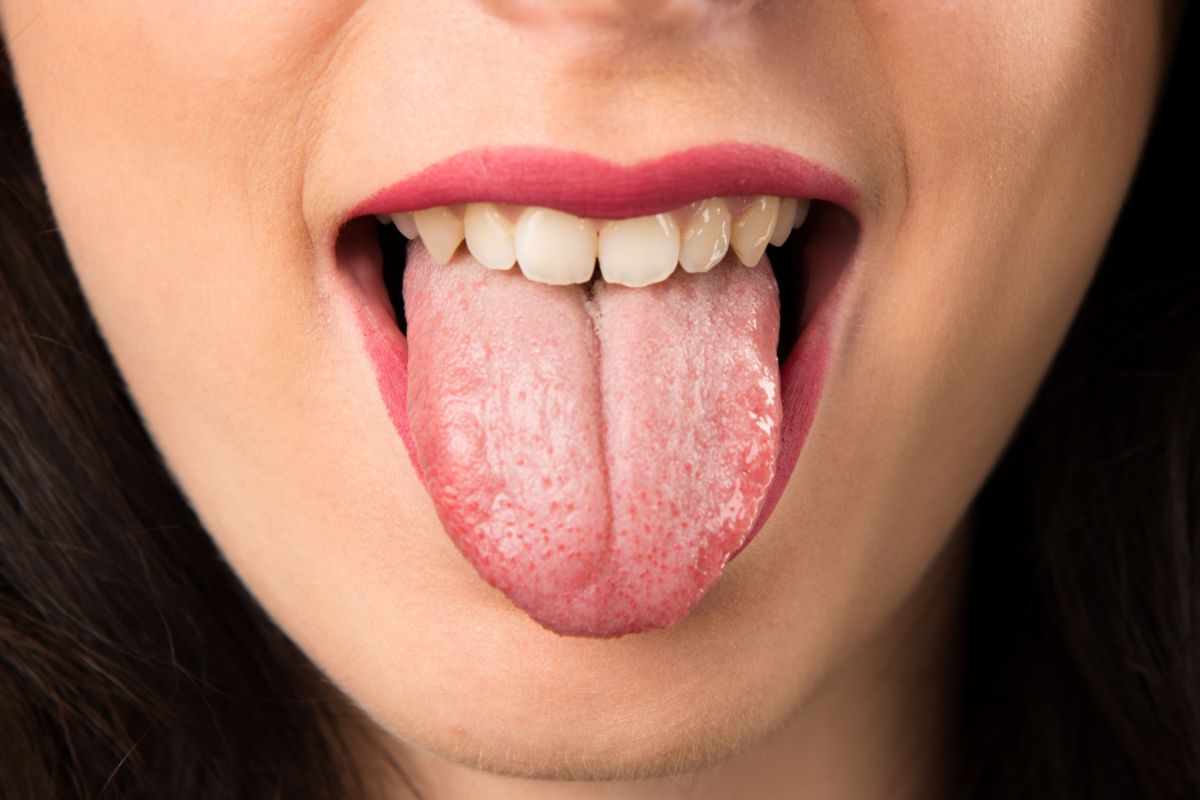 Candida Overgrowth: Causes and Solutions - Candida Overgrowth & Gut ...