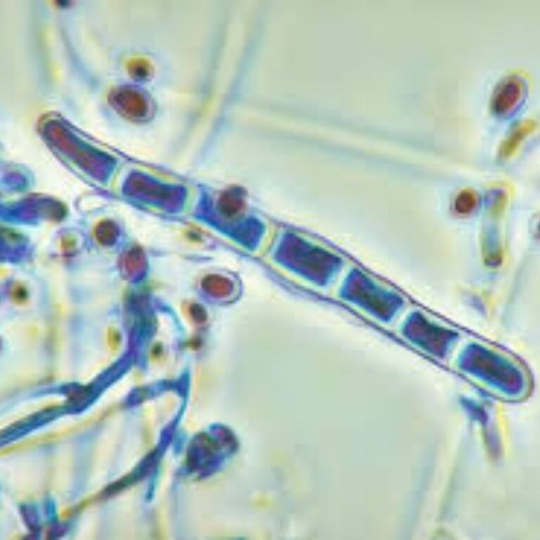 Athlete's Foot - Candida.com