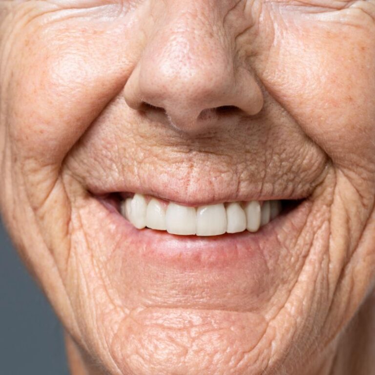 Oral Thrush In Mouth, Causes, Symptoms and Treatment - Candida.com