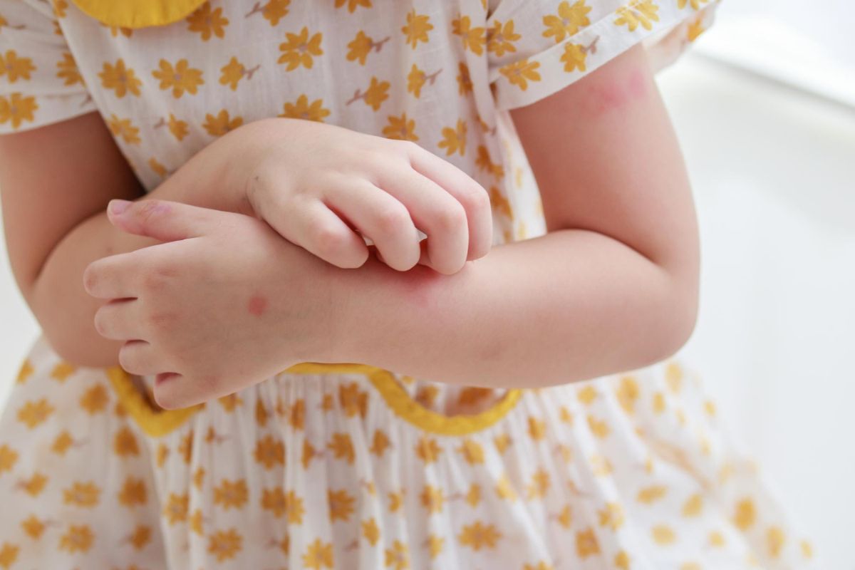 Children's Yeast Infection - Candida.com