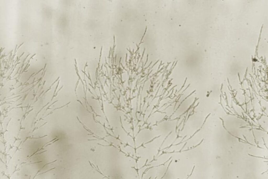 Candida Krusei: Understanding This Fungus - Candida.com