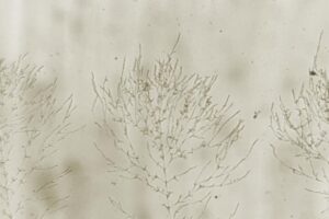 Candida Krusei: Understanding This Fungus - Candida Overgrowth & Gut ...