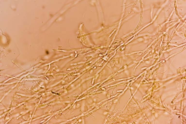 Candida Albicans: Understanding Its Common Role - Candida.com