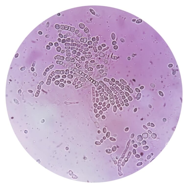 Candida Auris: Understanding Fungal Threats Today - Candida Overgrowth ...